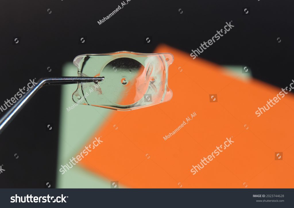 Implantable Collamer Lenses - Columbia Eye